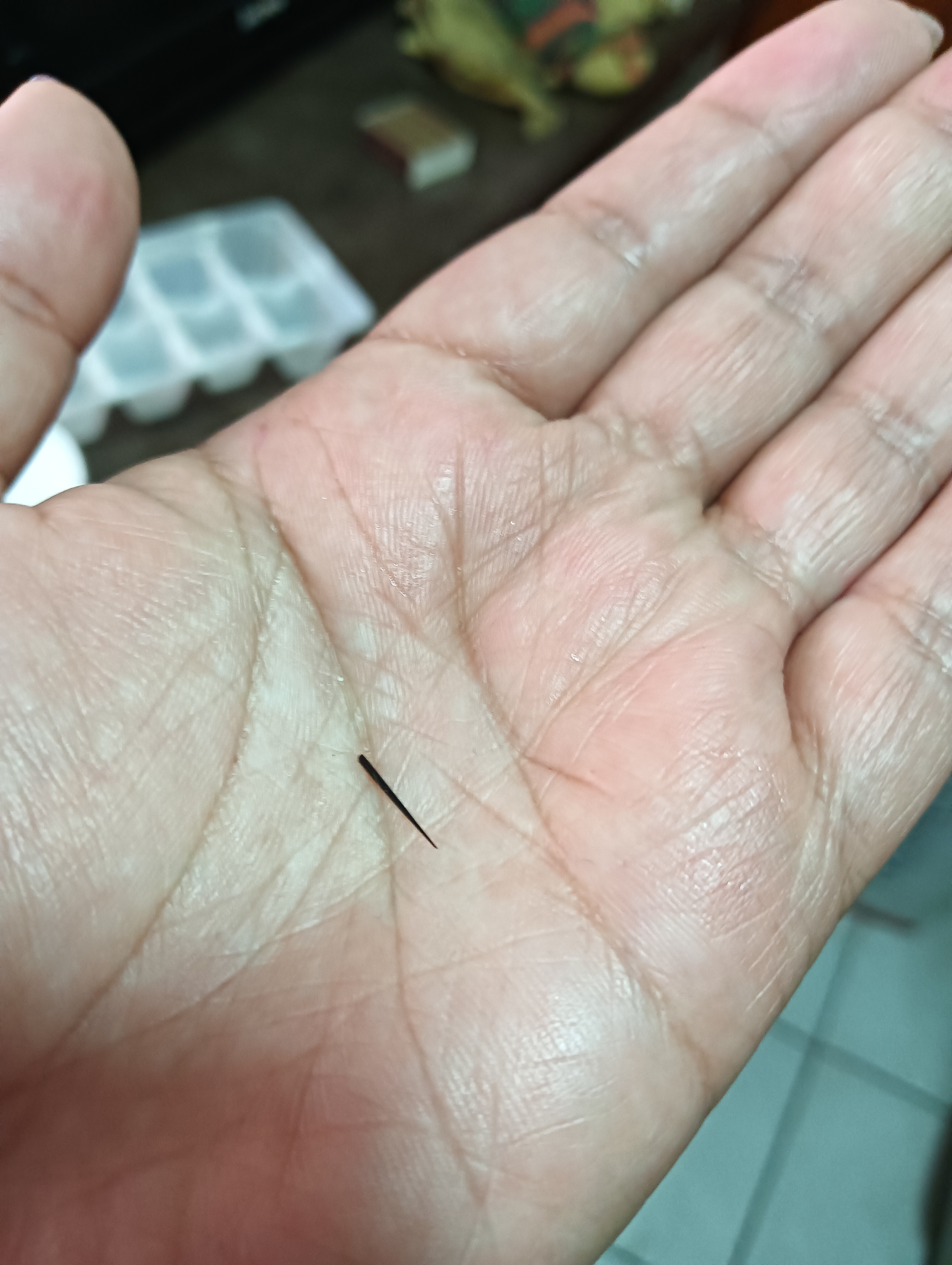 Wasil - Salió Una Espina Adentro De Un Palmito | RECLAMOS.CL
